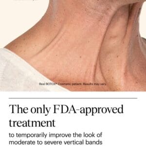 Botox For Platysmal Bands | Affordable Care | Rénove Med Spa | Neck ...